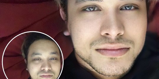 Kocak! Unggah Foto Oplas Challenge, Gilang Dirga Kok Mirip Ivan Gunawan